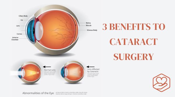 3 Benefits to Cataract Surgery – Mission Creek Optometry